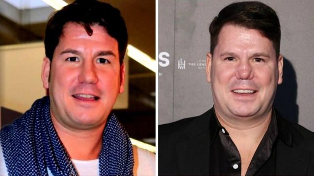 Lucas, de 'Andy y Lucas', aparece en un evento en Madrid con una nariz ...