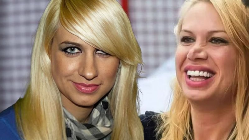 El cirujano de Vanessa Bouza da detalles de su complicada rinoplastia