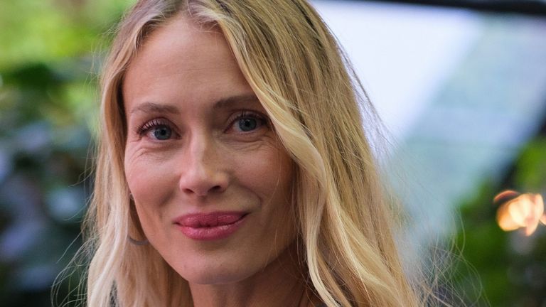 Vanesa Lorenzo explica la historia de sus cicatrices: "Nunca olvidemos ...