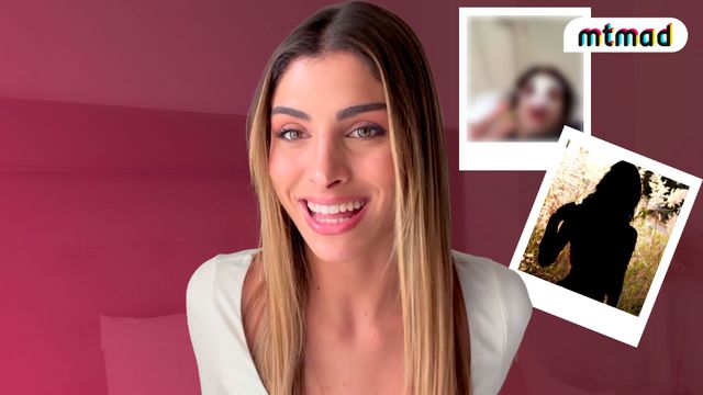 Alba Rodríguez: el antes y después de su rinoplastia - La isla de las ...