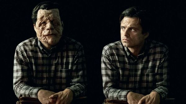 La historia de Adam Pearson, la cara visible de una enfermedad incurable