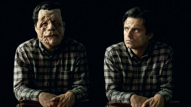 La historia de Adam Pearson, la cara visible de una enfermedad incurable