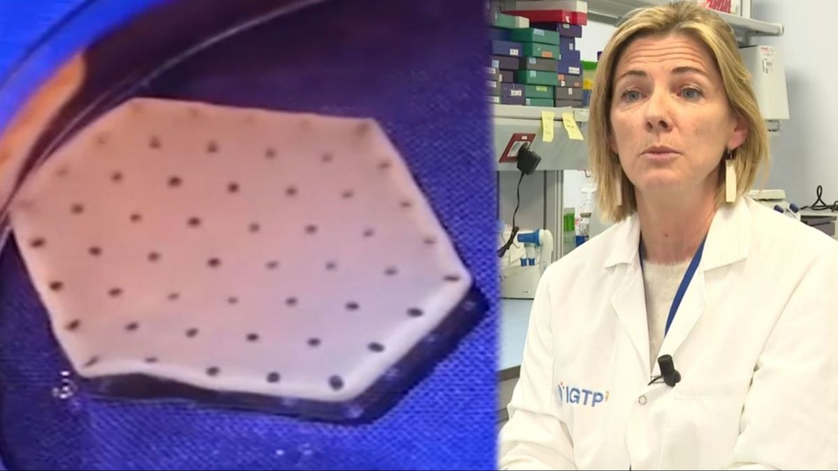 Nuevo avance en medicina: un parche capaz de curar un corazón infartado