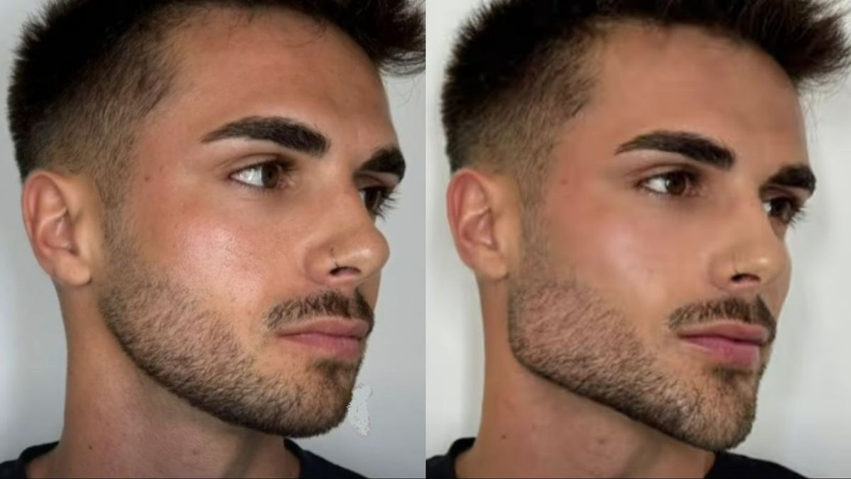 Joel Benedicto, de La isla de las tentaciones 8, viral por su retoque estético en la cara