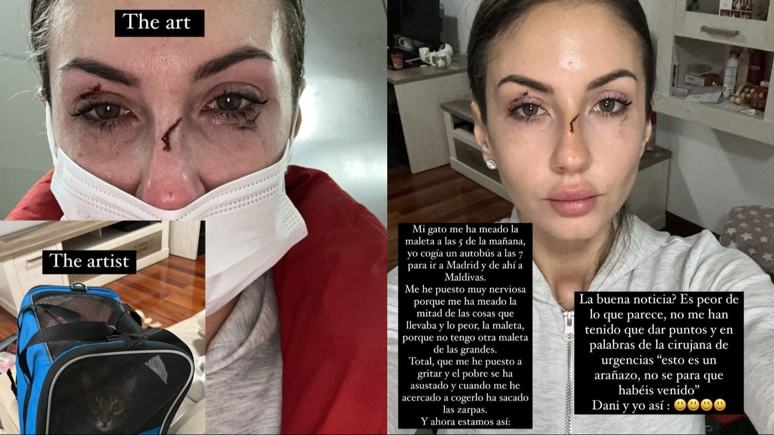 La streamer Gonsabellla, en urgencias tras ser atacada por su gato: "Me ha arrancado la nariz"