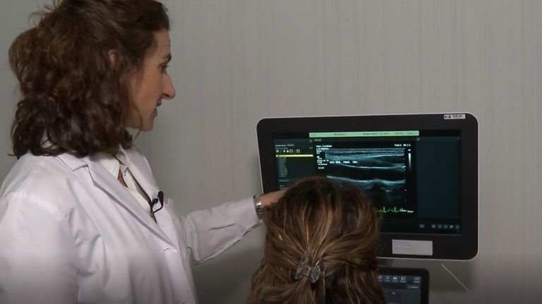 Buscan a más de 700 mujeres para prevenir el ictus en un nuevo estudio