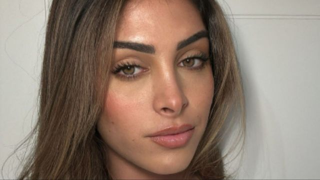 Alba Rodríguez niega tener nistagmo - La isla de las tentaciones