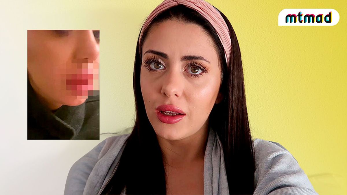 Los desastres estéticos que Rosario Matew ha sufrido en el rostro ...