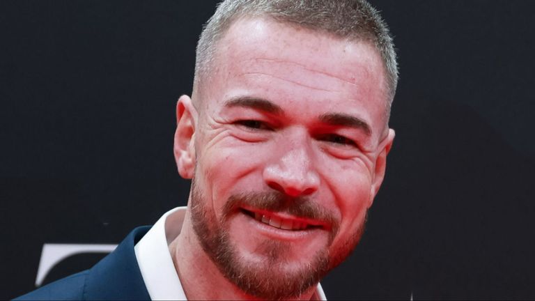 Tony Spina se somete a un retoque estético para acabar con su mayor ...