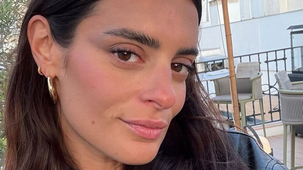Susana Molina habla de la enfermedad autoinmune que le han diagnosticado