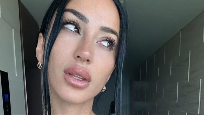 Aurah Ruiz se retira el ácido de los labios y enseña el resultado ...