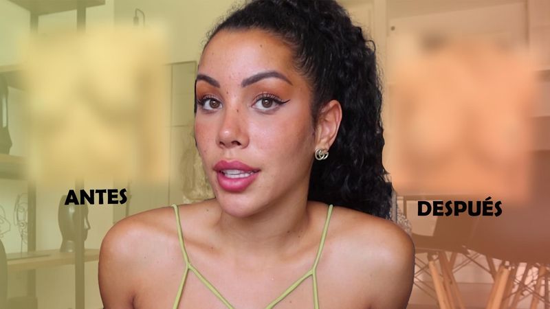 Bayan Al Masri muestra el antes y después de su operación de pecho