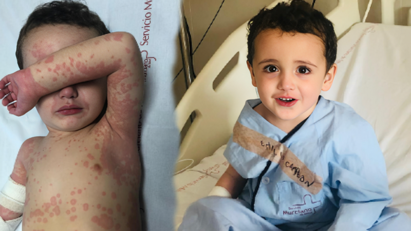 Confundieron 'un virus' con la enfermedad de Kawasaki: "Podría haber ...