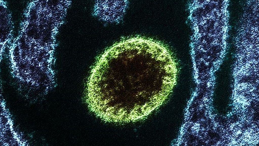 Qué es el Virus Nipah: sus síntomas y cómo se trasmite